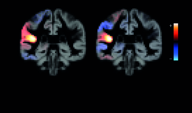 Biomedical Engineering | Biomedical Engineering